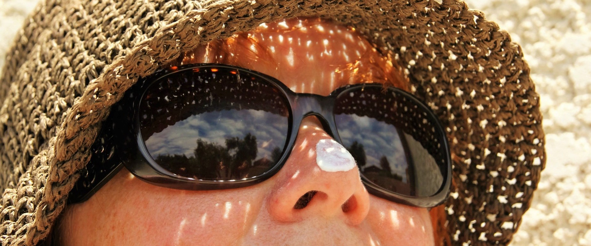 Protect Yourself from Skin Cancer: Understanding the Risk Factors